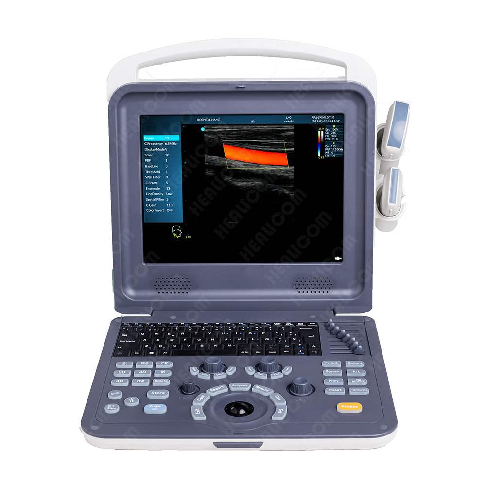 HUC-260 Portable Color Doppler Ultrasound Scanner from China ...